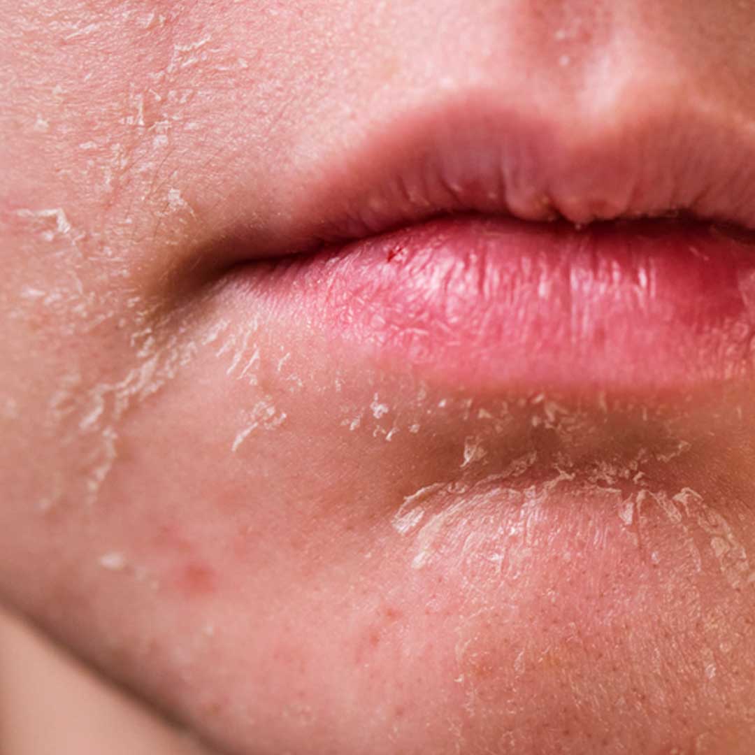 Best Skincare Products For Dry & Dull Skin - Rivela Dermascience